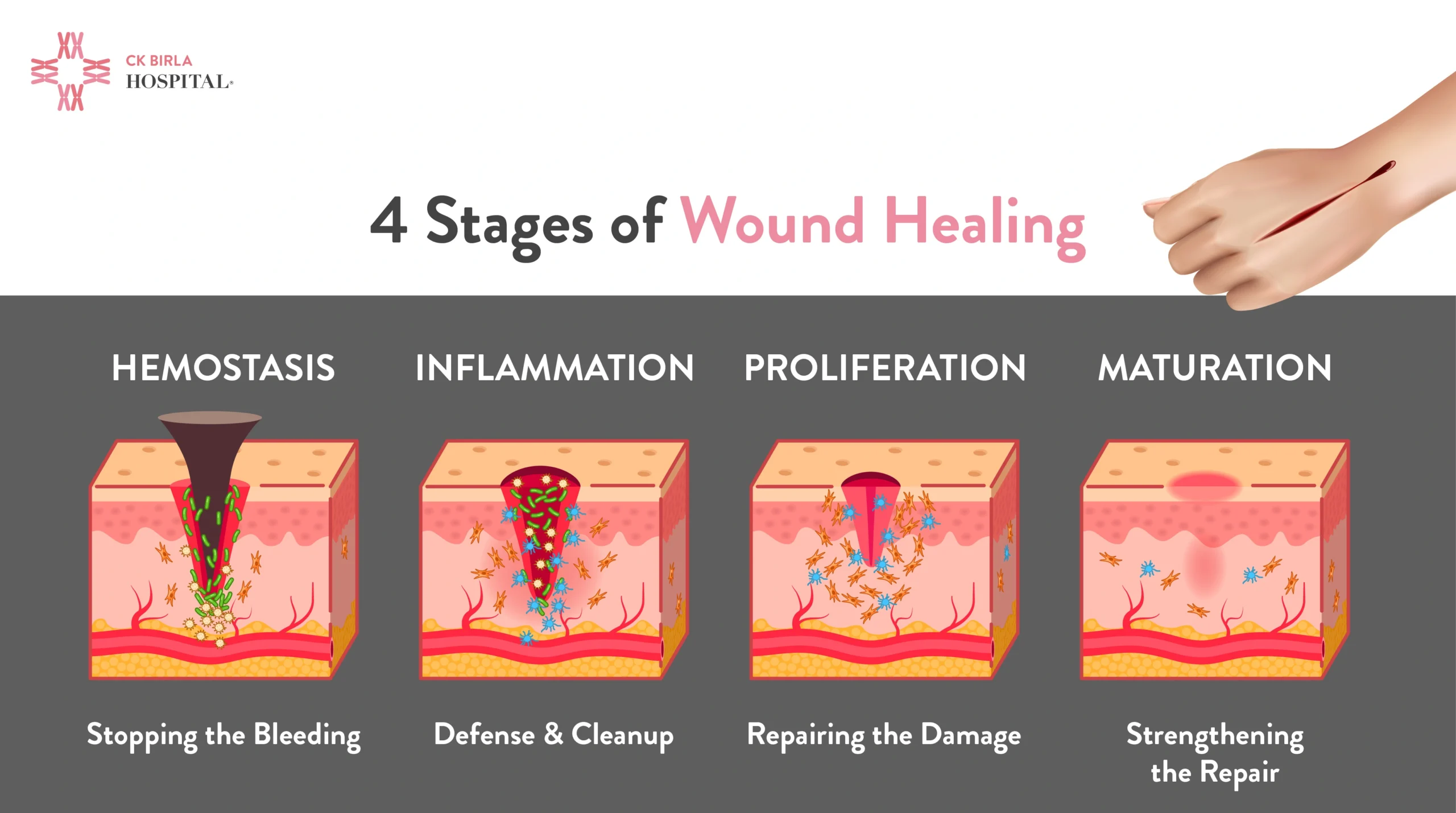 Surgical Wound Healing Stages Pictures Clear Visual Guide